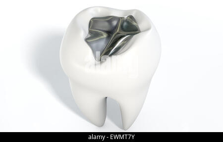 A lead cavity filling on a single molar on an isolated background Stock ...