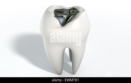 A lead cavity filling on a single molar on an isolated background Stock ...