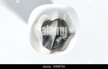 A lead cavity filling on a single molar on an isolated background Stock ...