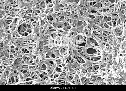 Scanning electron micrograph of Borrelia burgdorferi spirochete ...