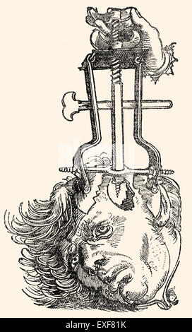 Medieval surgical treatment. Illustrations from treatise by John ...