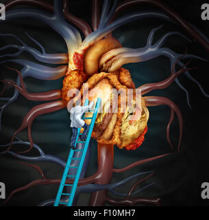 Arterial plaque surgery as a doctor cleaning an artery concept as a ...