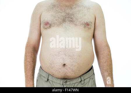 Obese man with fat stomach, front view Stock Photo - Alamy