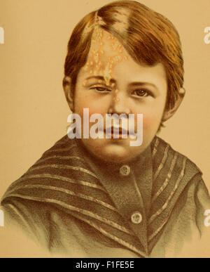 An American text-book of the diseases of children (1895 Stock Photo - Alamy