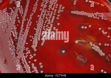 blood agar culture plate growing Bacillus anthracis (anthrax) and other ...
