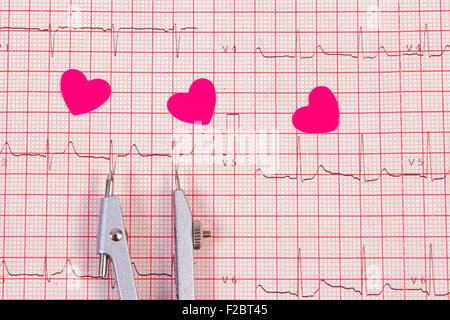 Electrocardiogram graph and calipers, ekg heart rhythm, medicine ...