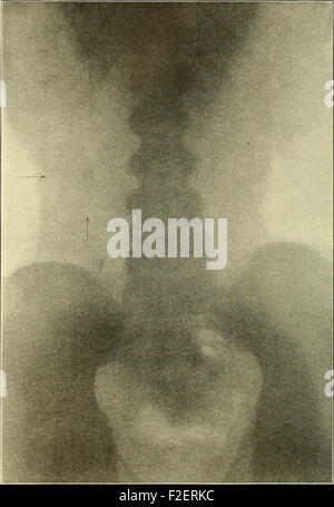 Operative Gynecology (1906) provides detailed accounts of surgical ...