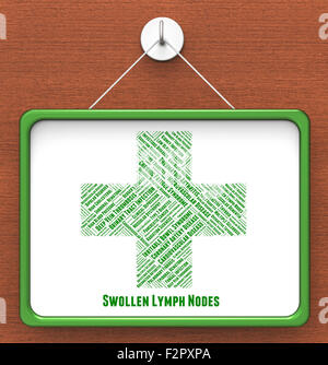 Swollen Lymph Nodes Indicating Infectious Lymphadenitides And ...