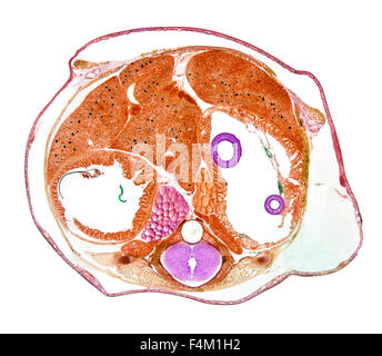 Brightfield photomicrograph, stained section of frog stomach showing ...