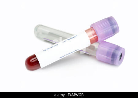 Blood test tubes with lavender or purple tops. Used for blood tests ...