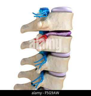 Spinal cord under pressure of bulging disc. Xray view. Medically ...