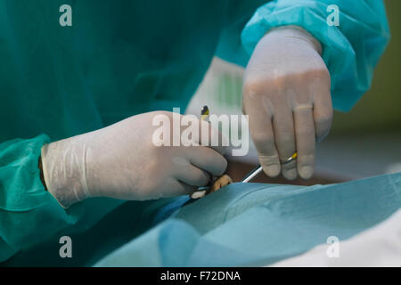 A doctor prepares a body for organ extraction in a hospital morgue in ...