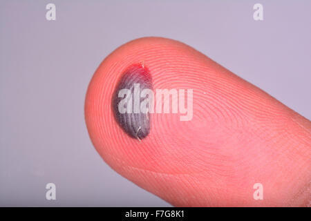 Blood on finger tip from blood test pin prick Stock Photo - Alamy