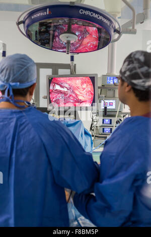 Surgical team performing prostatectomy (prostate ablation) under ...