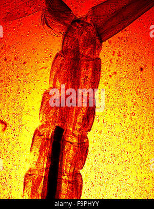 Mosquito larva under a microscope Stock Photo - Alamy