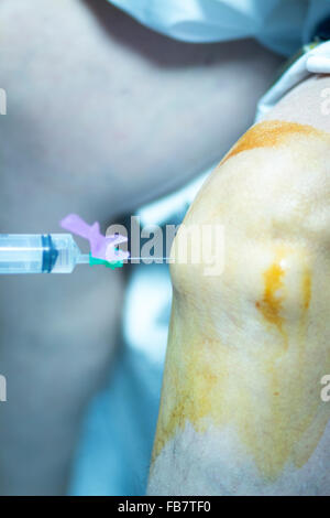 Knee surgery anaesthetic injection during operation in hospital ...