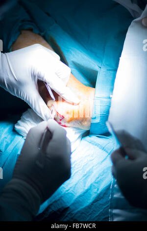 Hospital elbow and arm orthopedics surgery Traumatology operation photo ...