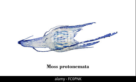 Light photomicrograph of Moss protonemata whole mount seen through ...