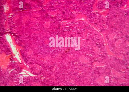 Pancreas tissue under the microscope Stock Photo - Alamy