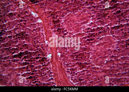 Pancreas tissue under the microscope Stock Photo: 93552932 - Alamy
