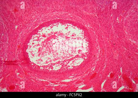 Ovary tissue under the microscope Stock Photo - Alamy