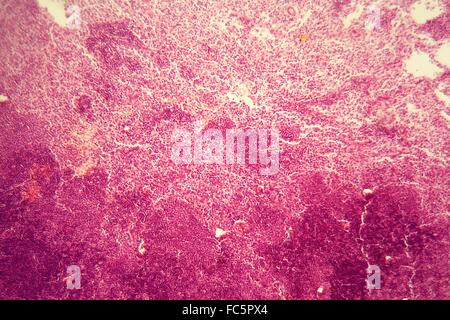 Lymph node under the microscope Stock Photo: 93555454 - Alamy