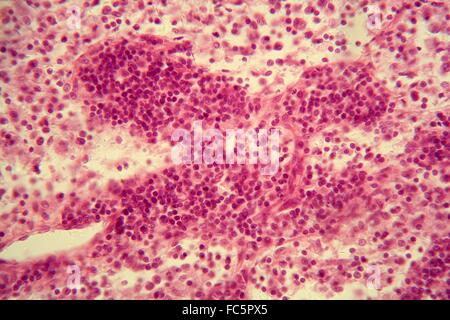 Lymph node under the microscope Stock Photo - Alamy
