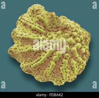 Sand microfossils. Coloured scanning electron micrograph (SEM) of ...