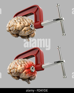 Vise with human brain. Headache or stress concept, 3D rendering ...