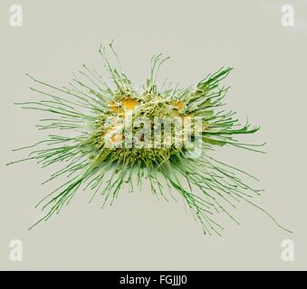 Dendritic cell. Coloured scanning electron micrograph (SEM) of a ...