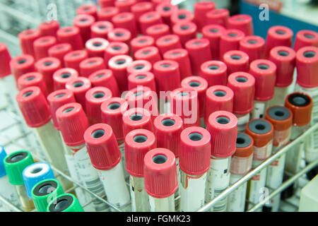 Rack with test tubes, plastic bottle, pipette vials with chemicals ...