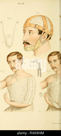 An 1859 manual detailing the techniques, bandages, and devices used in ...