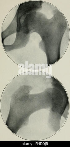 . American practice of surgery ; a complete system of the science and ...