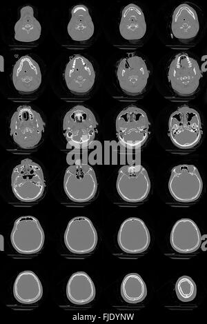 research in medicine. CT scan of the patient Stock Photo - Alamy