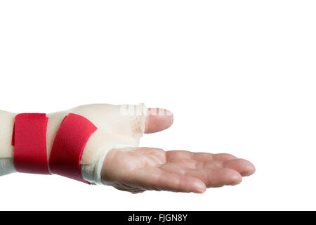 Wrist And Hand Palm Side Up Stock Photo - Alamy