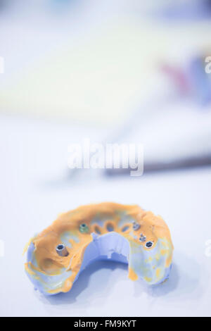 Dental mold dental impression plate in dentist's clinic Stock Photo - Alamy