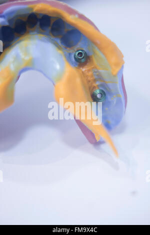 Dental mold dental impression plate in dentist's clinic Stock Photo - Alamy