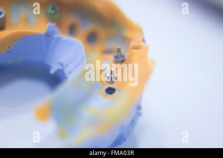 Dental mold dental impression plate in dentist's clinic Stock Photo - Alamy