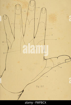 The malformations, diseases and injuries of the fingers and toes and ...