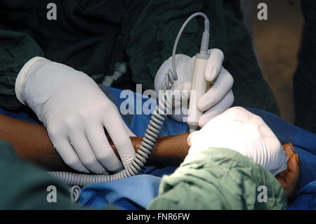 Surgeons use a cartoid Doppler machine to check for a pulse on the arm ...