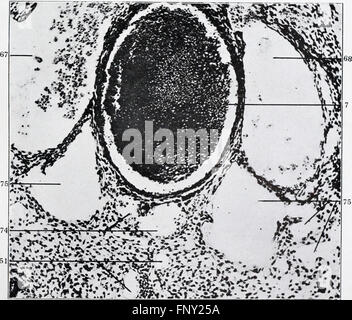 This 1911 study explores the anatomy and development of systemic ...