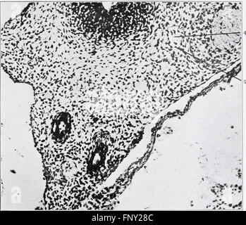 This 1911 study details the anatomy and development of the lymphatic ...