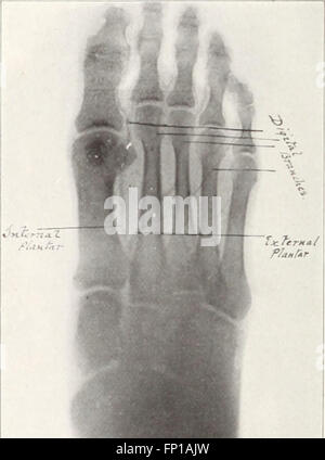 The 'American X-ray Journal' (1897) covers the early developments of X ...