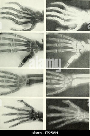This 1915 work discusses the applications of radiography, x-ray ...