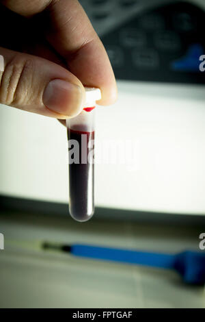 Coagulated blood sample for analysis Stock Photo - Alamy