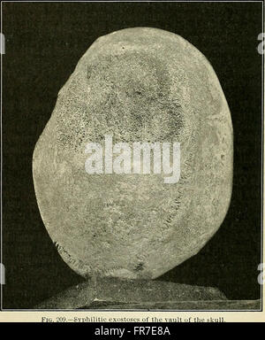 An American Text-Book of Genito-Urinary Diseases, Syphilis and Diseases ...