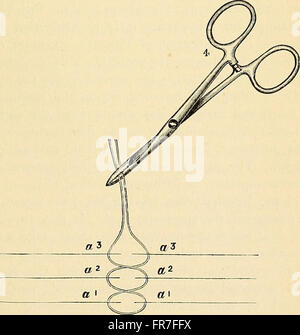 This 1893 book, 'A System of Genito-Urinary Diseases, Syphilology, and ...