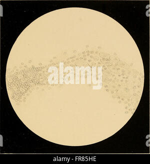 An 1885 atlas illustrating clinical microscopy techniques, featuring ...