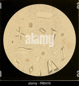 An 1885 guide to clinical microscopy, focusing on the examination of ...