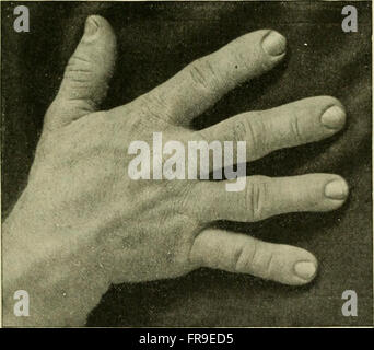 This text-book covers the diagnosis, treatment, and prevention of ...